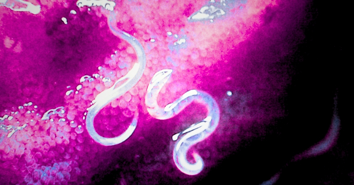 This Parasitic Worm Might Be the Future of Painkillers - EVOL - Evol News